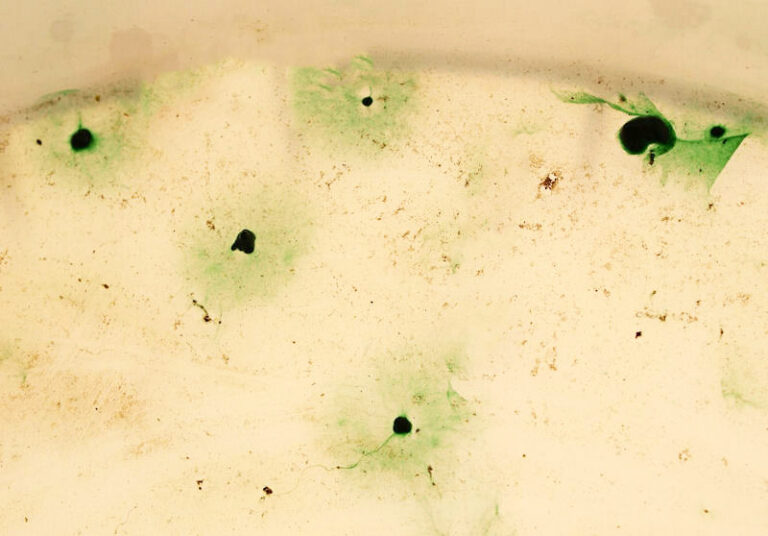Blue-Green Algae in Aquariums: How to Identify and Eliminate It