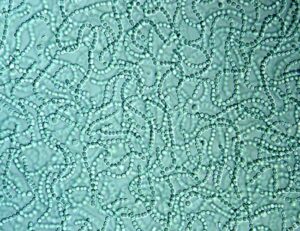 Blue-Green Algae in Aquariums: How to Identify and Eliminate It