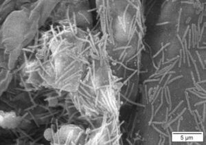 Identify and Treat Columnaris (Saddle Back Disease) | FishLab